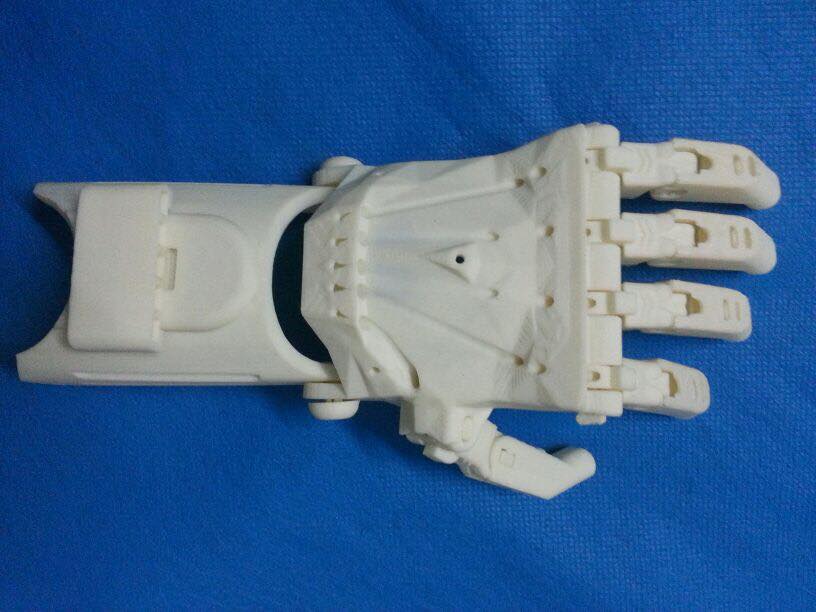 India’s first 3D printed hand prosthetics by hand care Foundation in ...